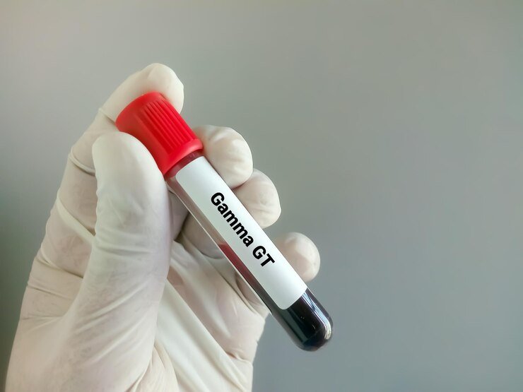 Gamma GT Diagnostic Plus